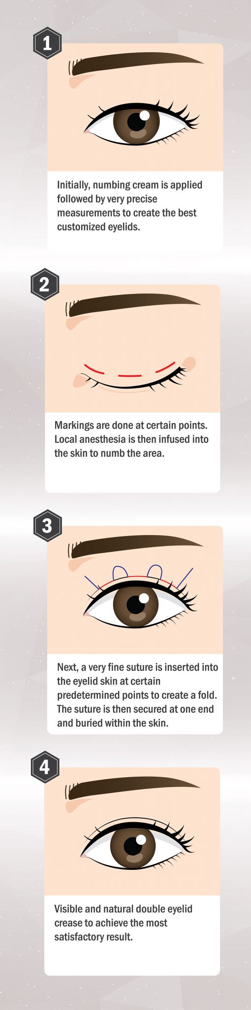Double Eyelid Suture Clinic RX
